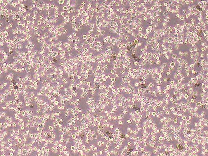 IOSE-80 Cells人正常卵巢上皮细胞种子实验室复苏 - 知乎