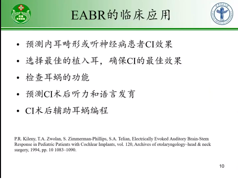 临床听力学技术专业沙龙｜人工耳蜗植入术中及术后EABR的应用 - 知乎