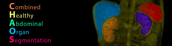 CHAOS 数据集介绍 - 知乎