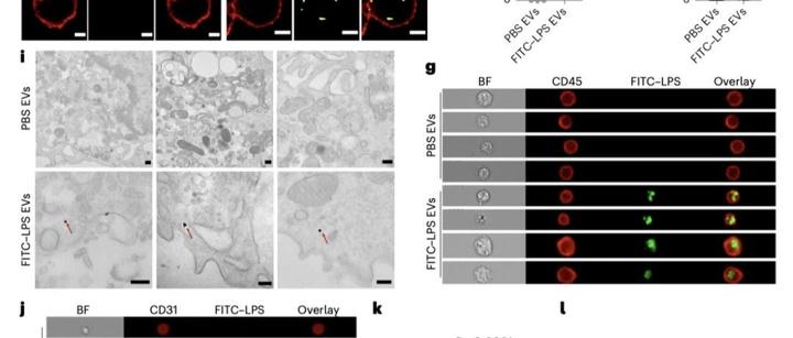 Nature Cell Biology丨循环外泌体可以携带 LPS 诱导焦亡 - 知乎