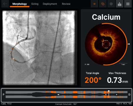 CCEC·前沿技术｜当人工智能“预见”OCT - 知乎