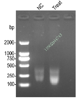 Merip-qPCR&merip-seq 实验步骤（甲基化RNA免疫共沉淀） - 知乎