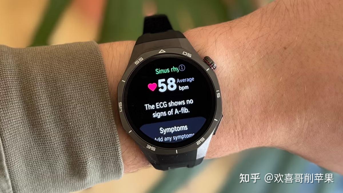 2025年6月智能手表攻略（48）技术贴：什么是心率监测（ECG ）手表，ECG 智能手表对跑步者的重要性？（6.4更新）