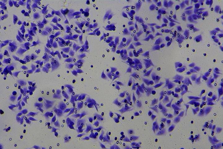 要检测细胞迁移能力，我应该选择Transwell实验还是划痕实验呢？ - 知乎