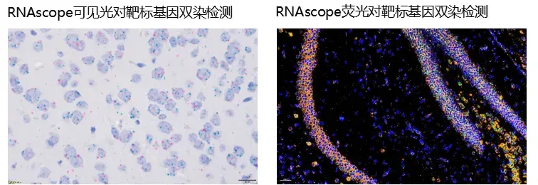 【病理专题】RNAscope技术介绍及应用 - 知乎