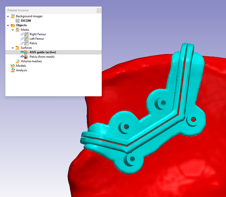 【Simpleware 教程】创建截骨导板 - 知乎