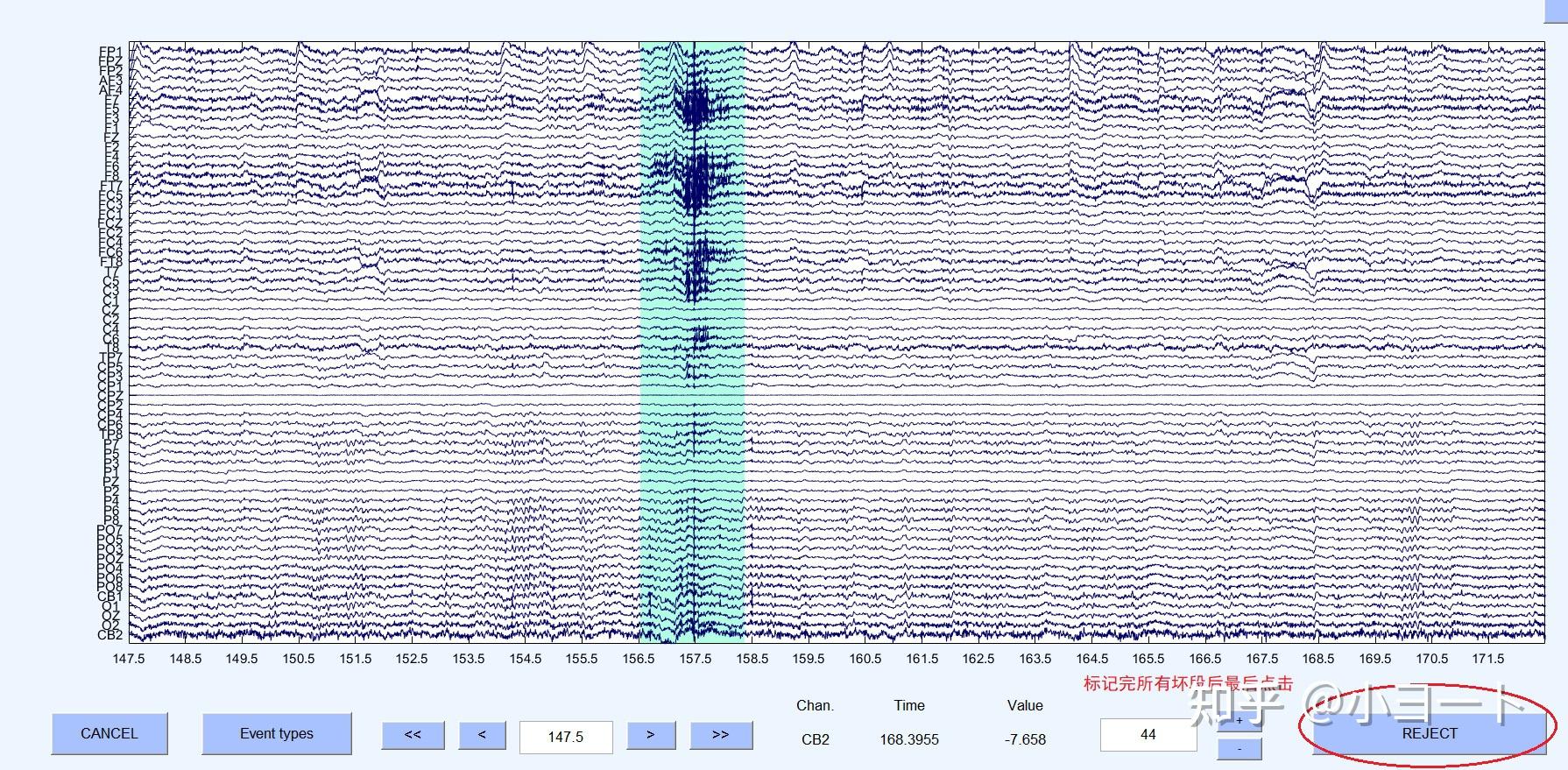手把手系列教程||使用EEGLAB2023版对脑电数据进行预处理 - 知乎